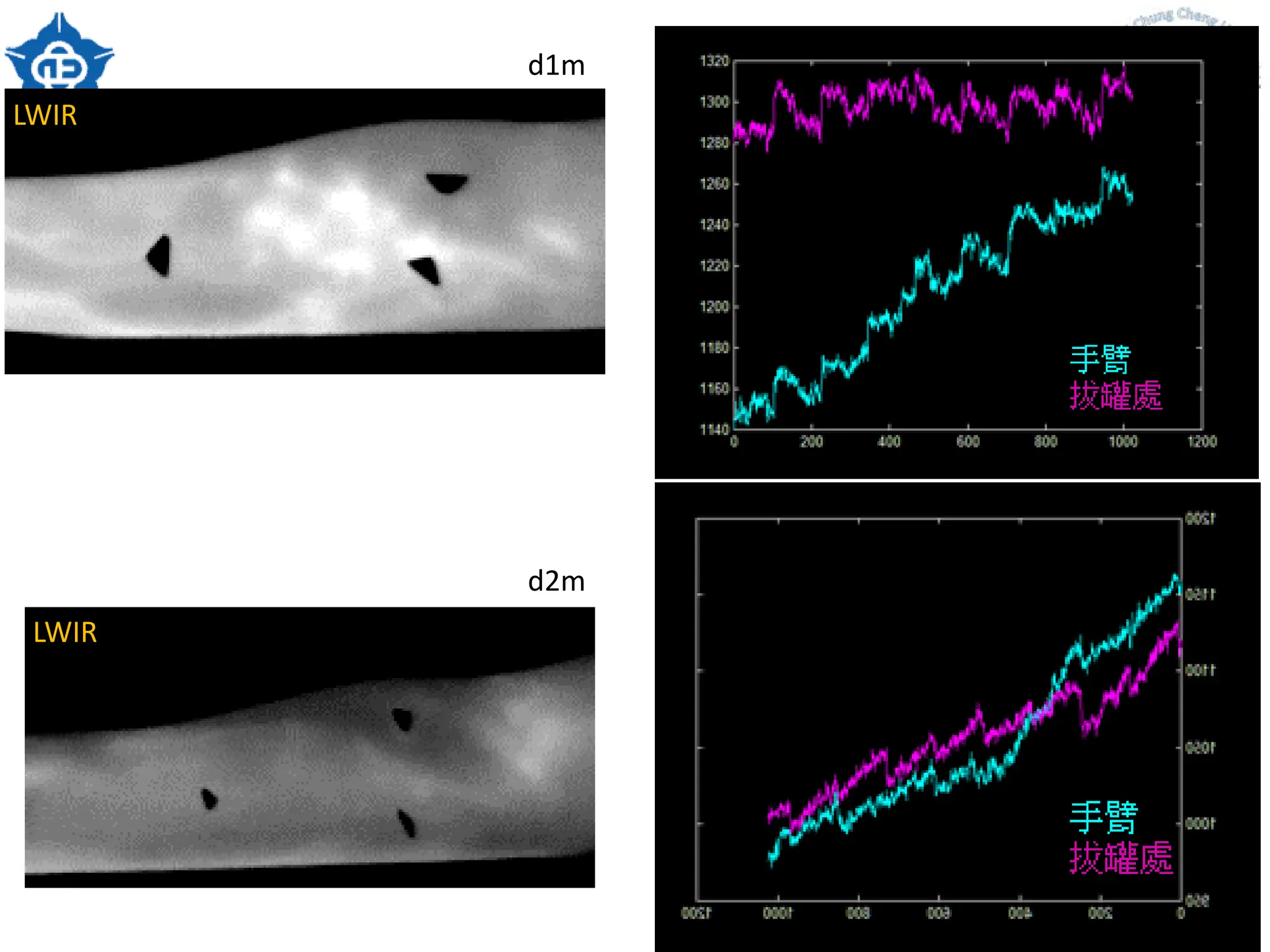 Hyperspectral imaging of bedsore and a simulation study for wound ...
