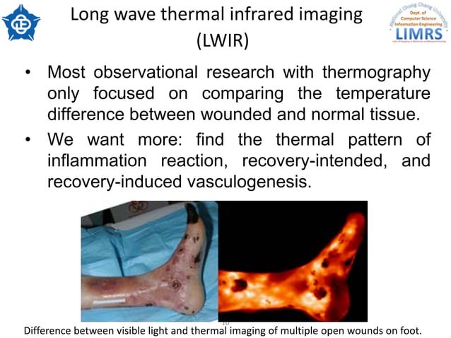 Hyperspectral imaging of bedsore and a simulation study for wound ...
