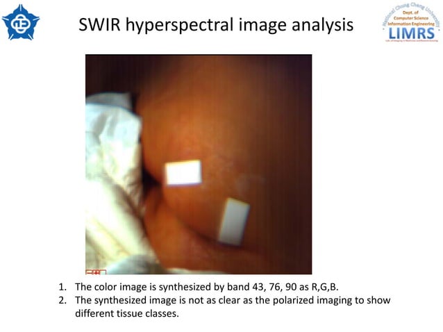 Hyperspectral imaging of bedsore and a simulation study for wound ...