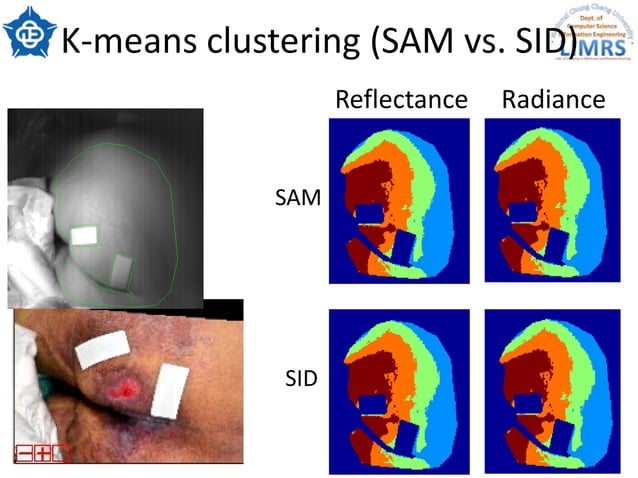 Hyperspectral imaging of bedsore and a simulation study for wound ...