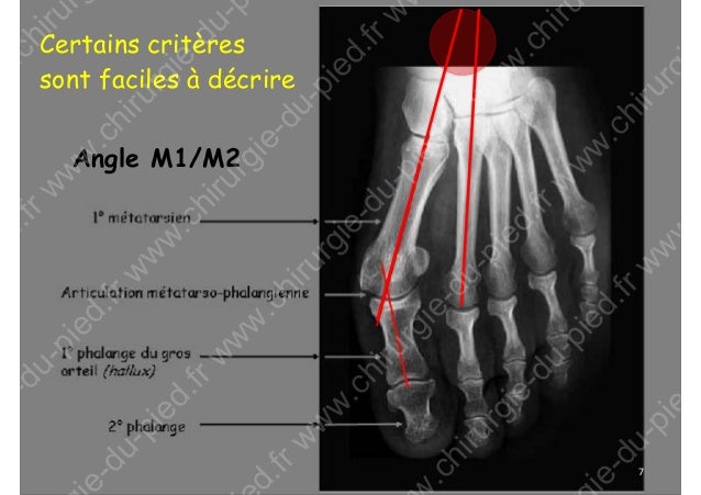 Radiologie ostéo-articulaire