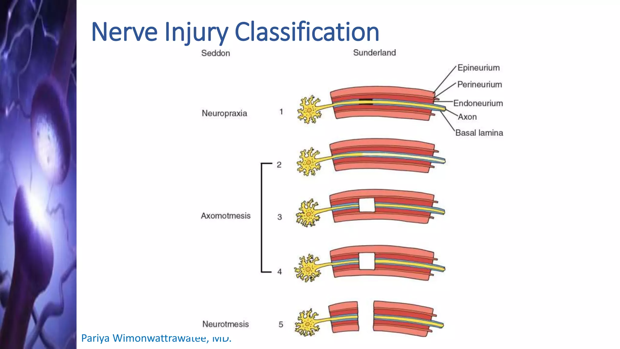 Nerve Entrapment & Injury for medical student 2017 | PPSX