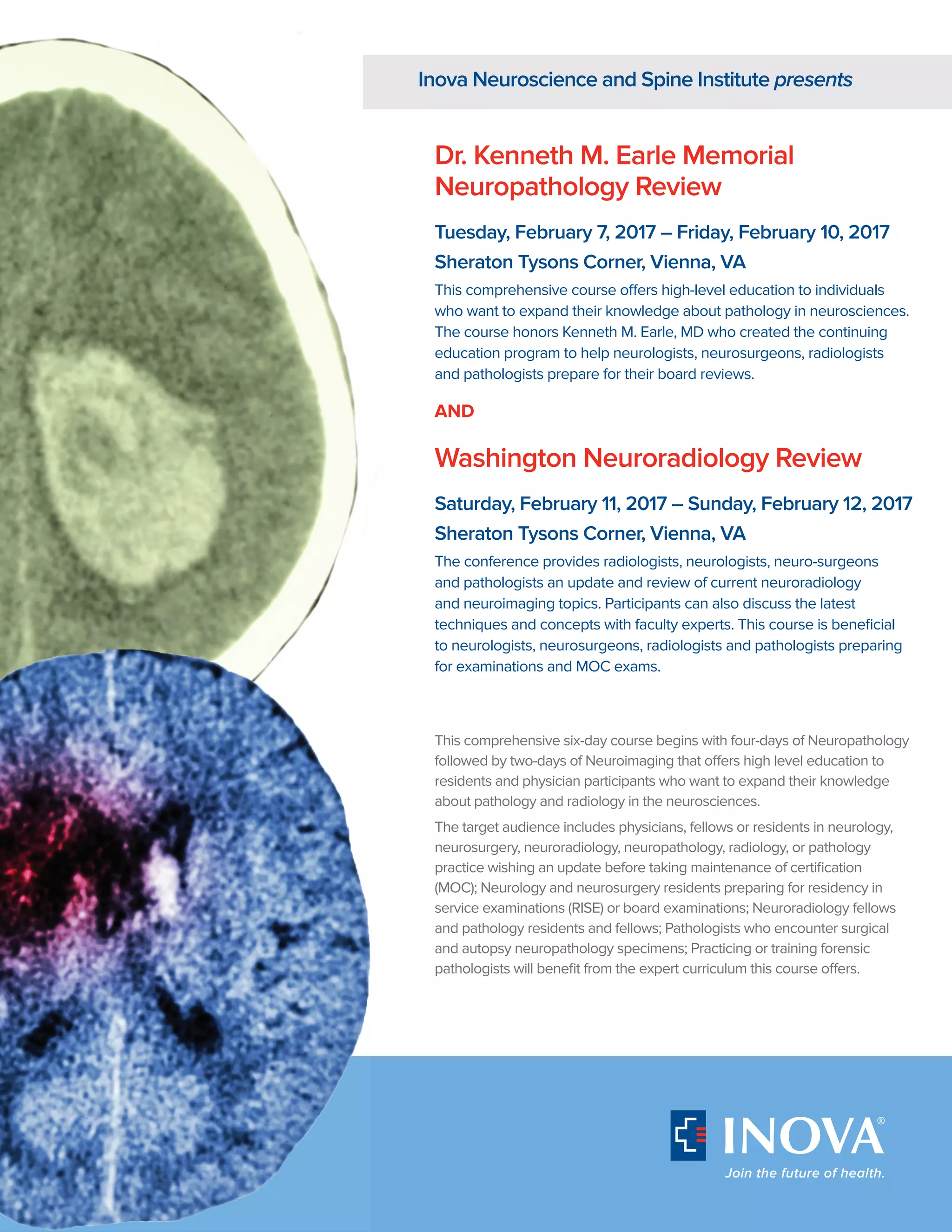 2017 Washington Neuroradiology and Neuropathology Review Courses | PDF