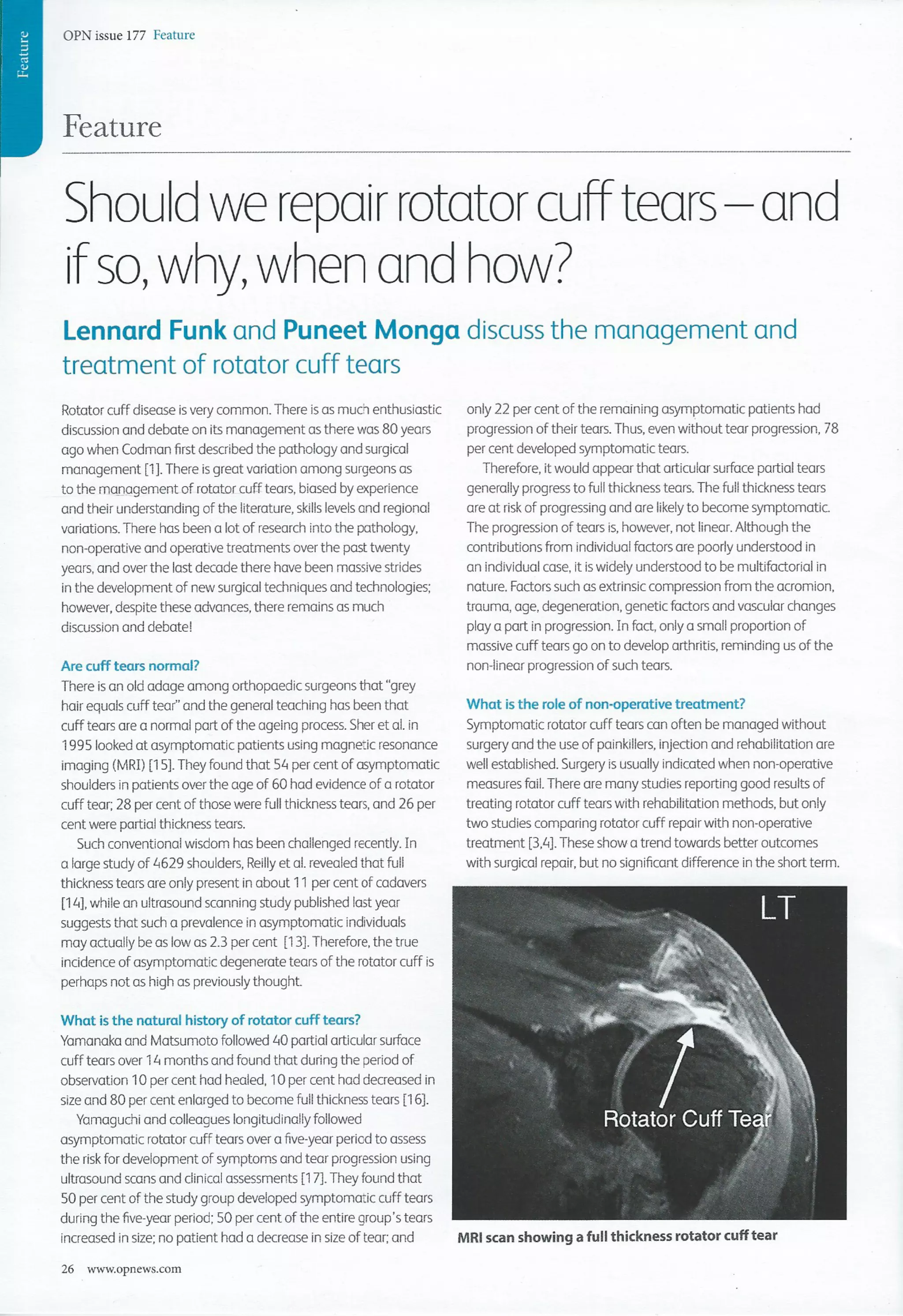 Should We Repair Rotator Cuff Tears OPN 2017.pdf