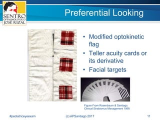 2017 Basic Pediatric Vision Examination | PDF