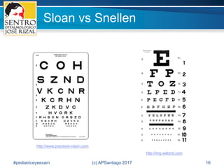 2017 Basic Pediatric Vision Examination | PPT