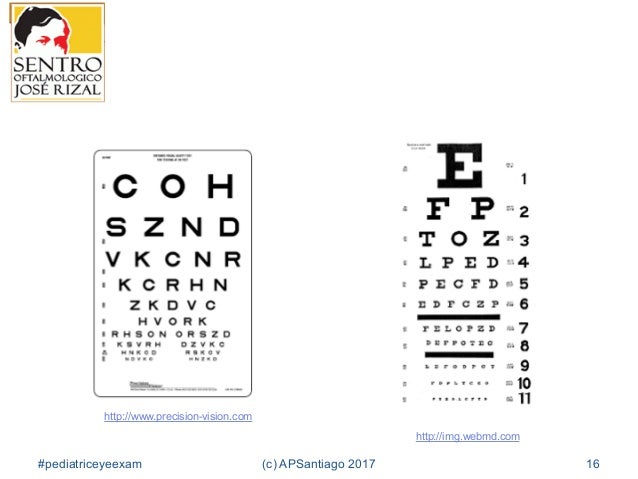 2017 Basic Pediatric Vision Examination 2017-basic-pediatric-vision-examination