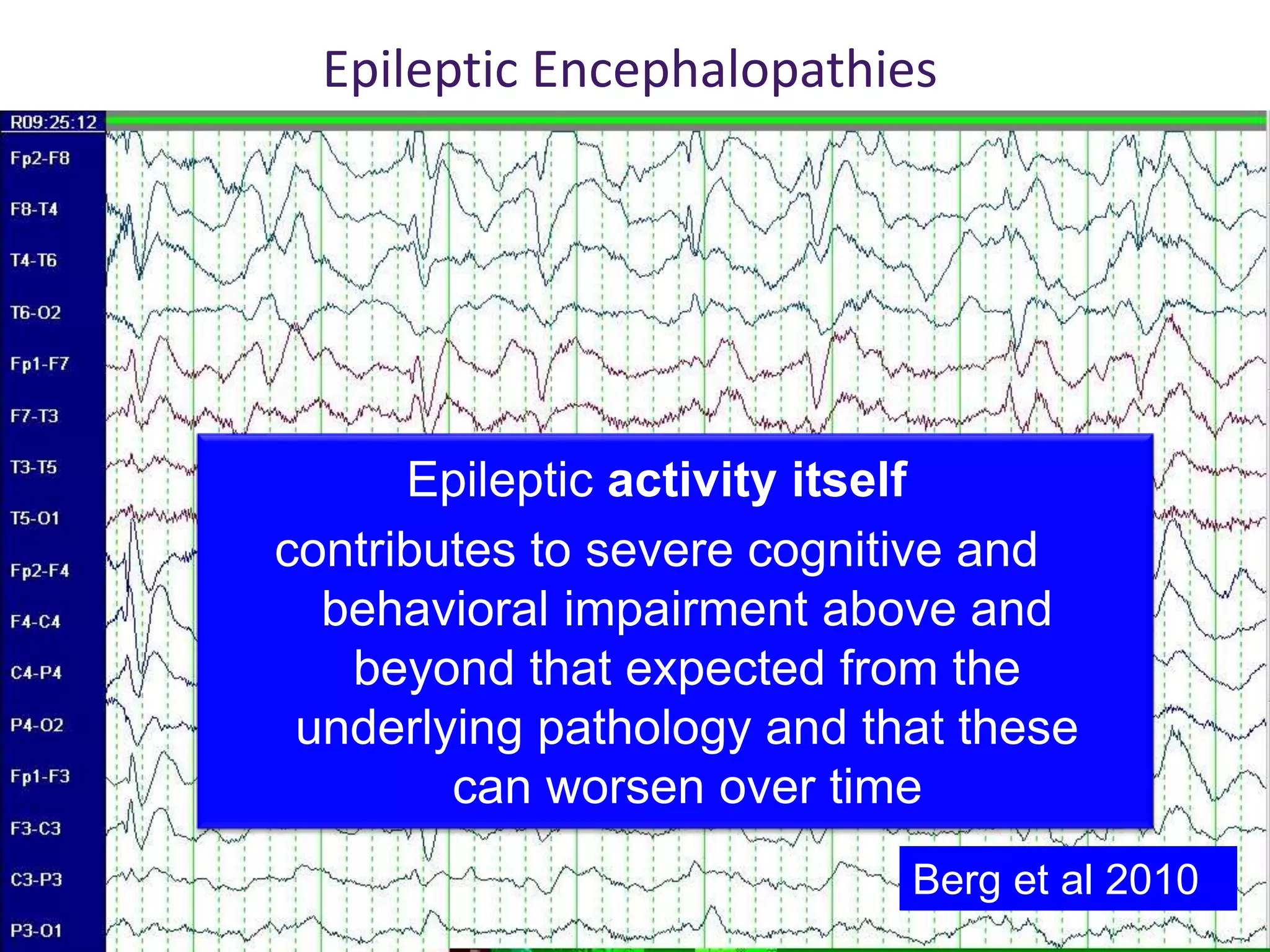 2017 revised ILEA classification of seizures | PPTX