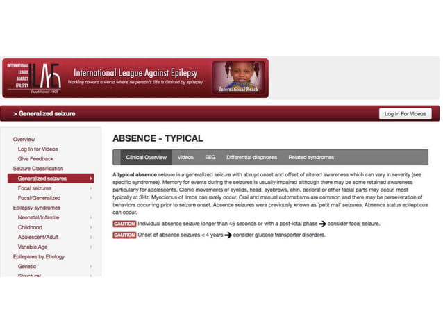 2017 revised ILEA classification of seizures | PPTX