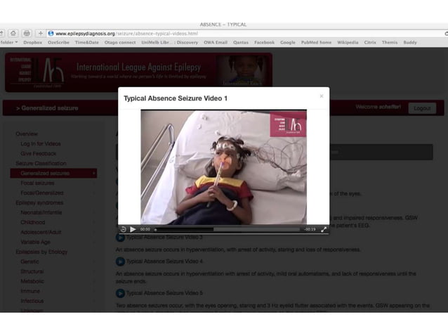 2017 revised ILEA classification of seizures | PPTX