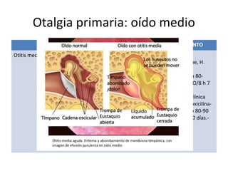 (2018 01-09) otalgia (ppt) | PPT