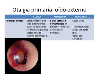 (2018 01-09) otalgia (ppt) | PPT