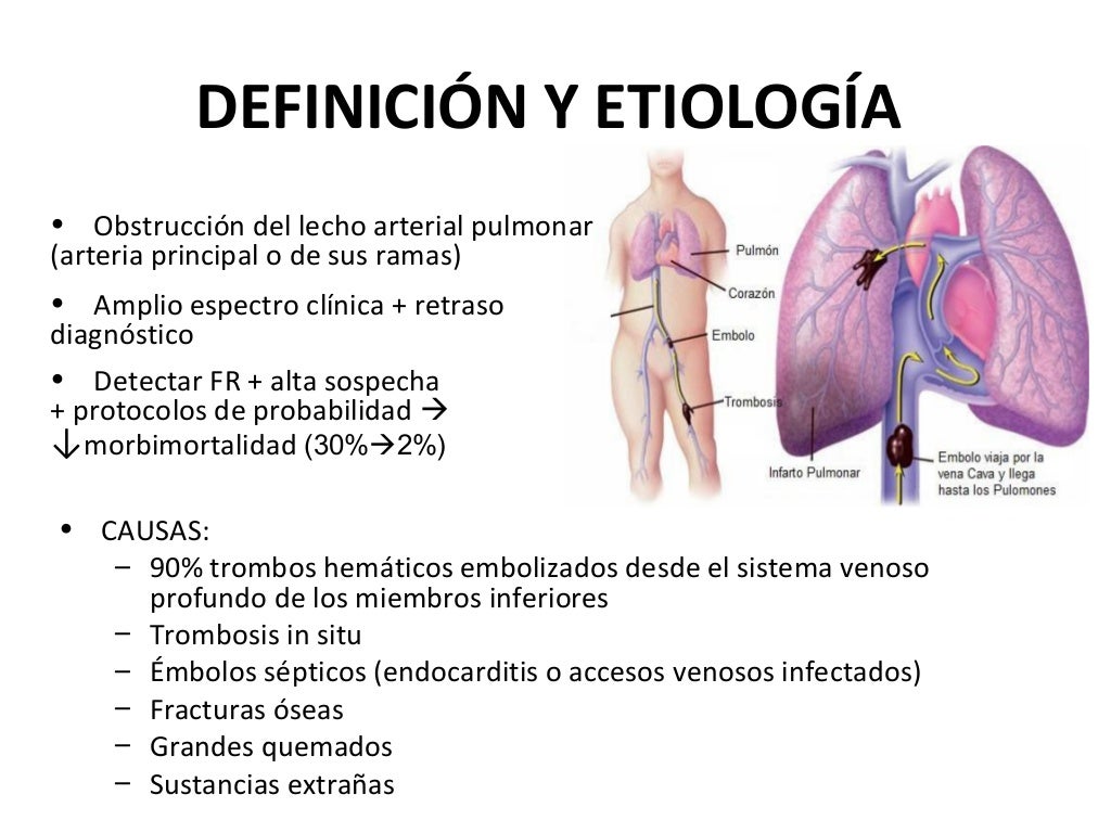 (2018 06-07) tromboembolia pulmonar (ppt)