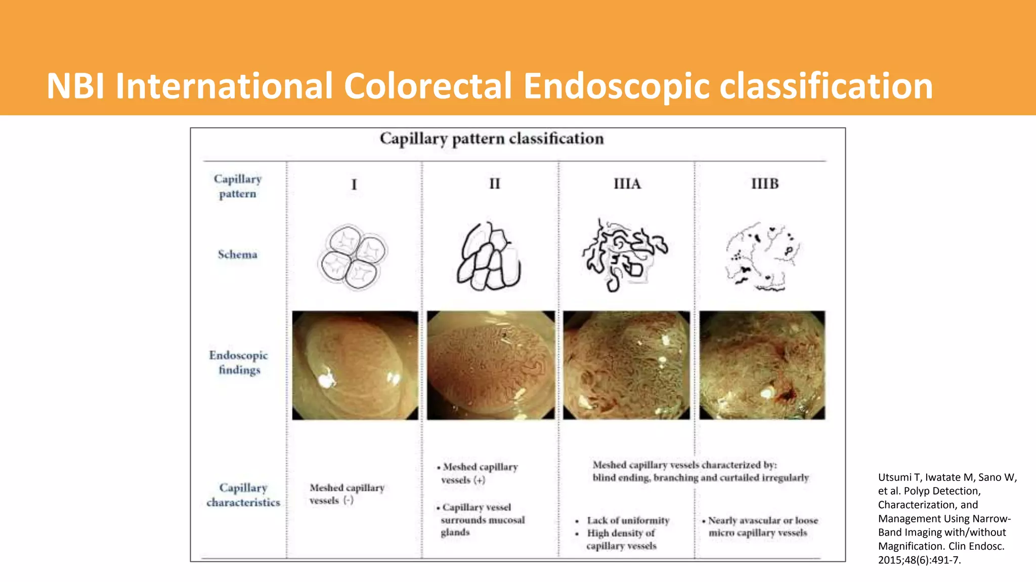 Real-time differentiation of adenomatous and hyperplastic diminutive ...