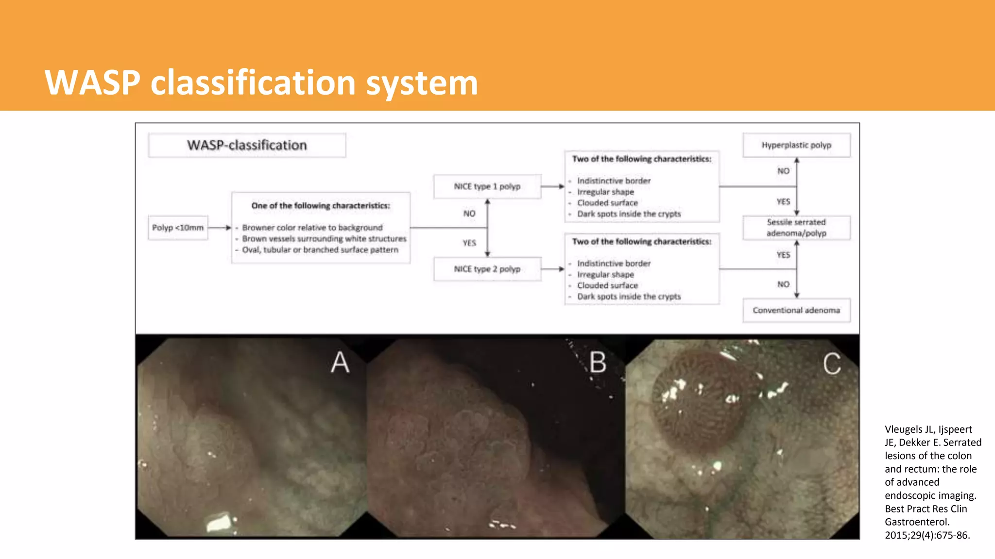 Real-time differentiation of adenomatous and hyperplastic diminutive ...