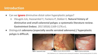 Real-time differentiation of adenomatous and hyperplastic diminutive ...