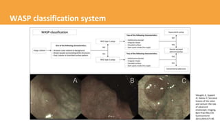 Real-time differentiation of adenomatous and hyperplastic diminutive ...