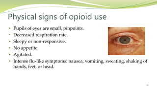 Heroin and Opioids Update : A Community Public Health and Safety Crisis ...