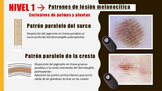 2018 11-06 dermatoscopia en atencion primaria.ppt