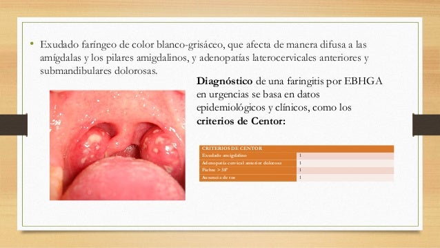 Patologa Inflamatoria Crnica Y Aguda Faringe