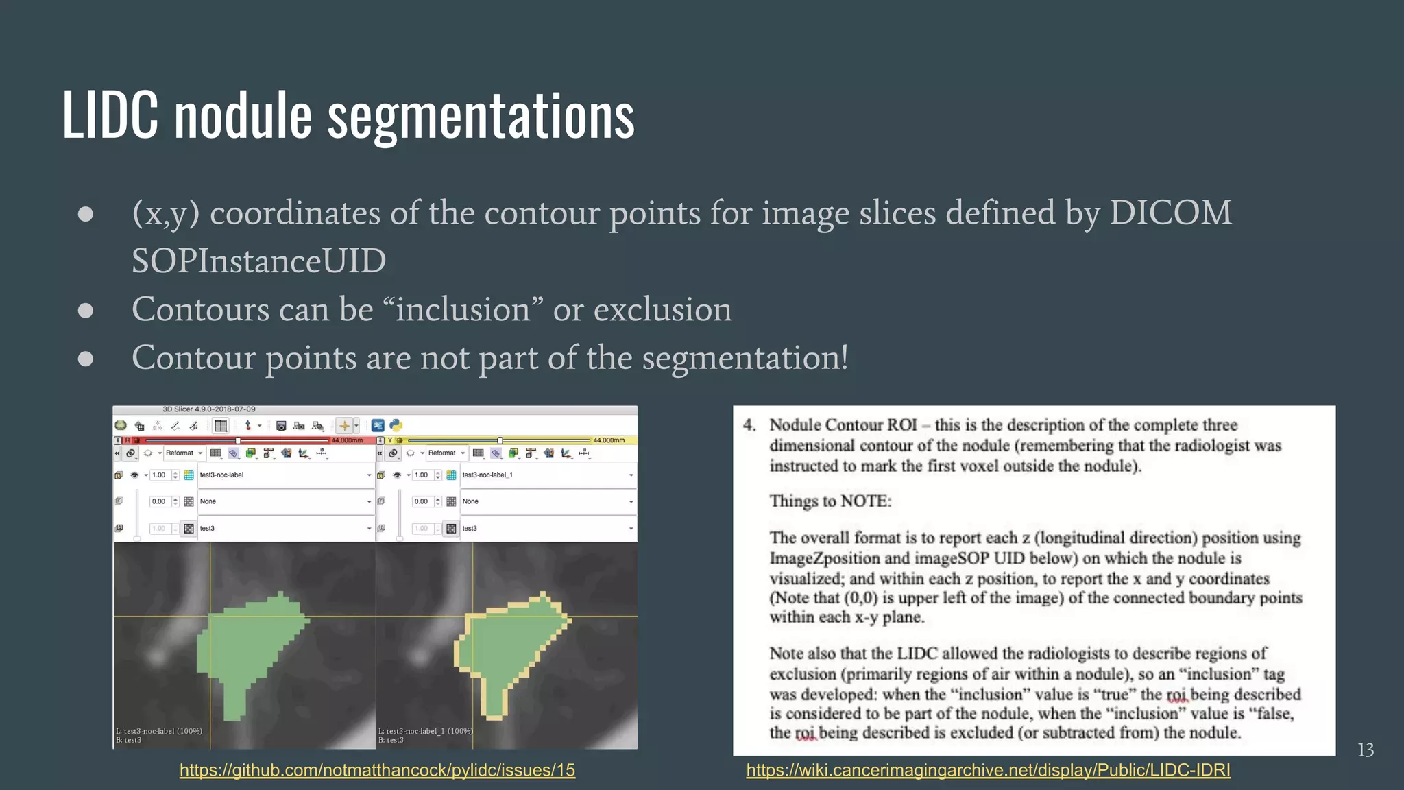 Standardized representation of the LIDC annotations using DICOM | PDF