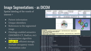 Standardized representation of the LIDC annotations using DICOM | PDF