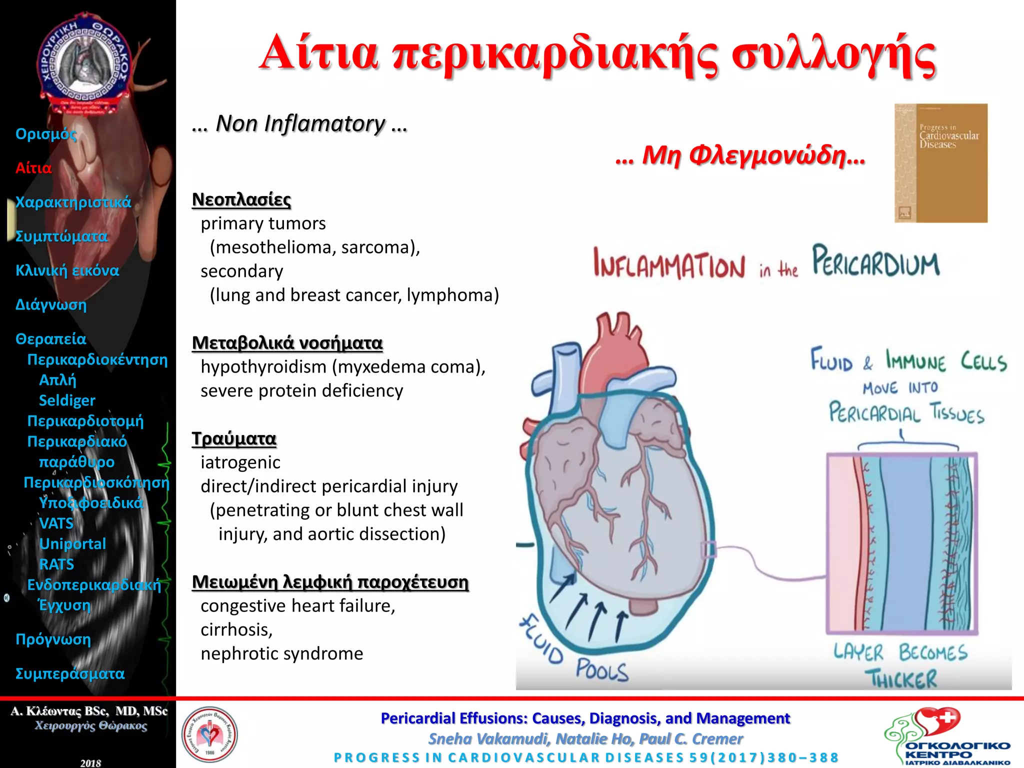 Surgical procedures for malignant pericardial efussion (kleontas ...