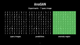 Unsupervised anomaly detection with generative model | PPT