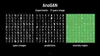 Unsupervised anomaly detection with generative model | PPT