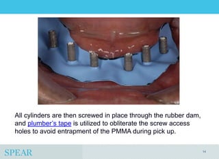 Conversion Prosthesis For an Implant-Supported Fixed Dental Prosthesis ...