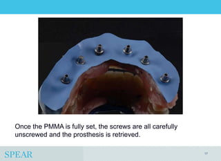 Conversion Prosthesis For an Implant-Supported Fixed Dental Prosthesis ...