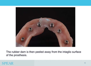 Conversion Prosthesis For an Implant-Supported Fixed Dental Prosthesis ...