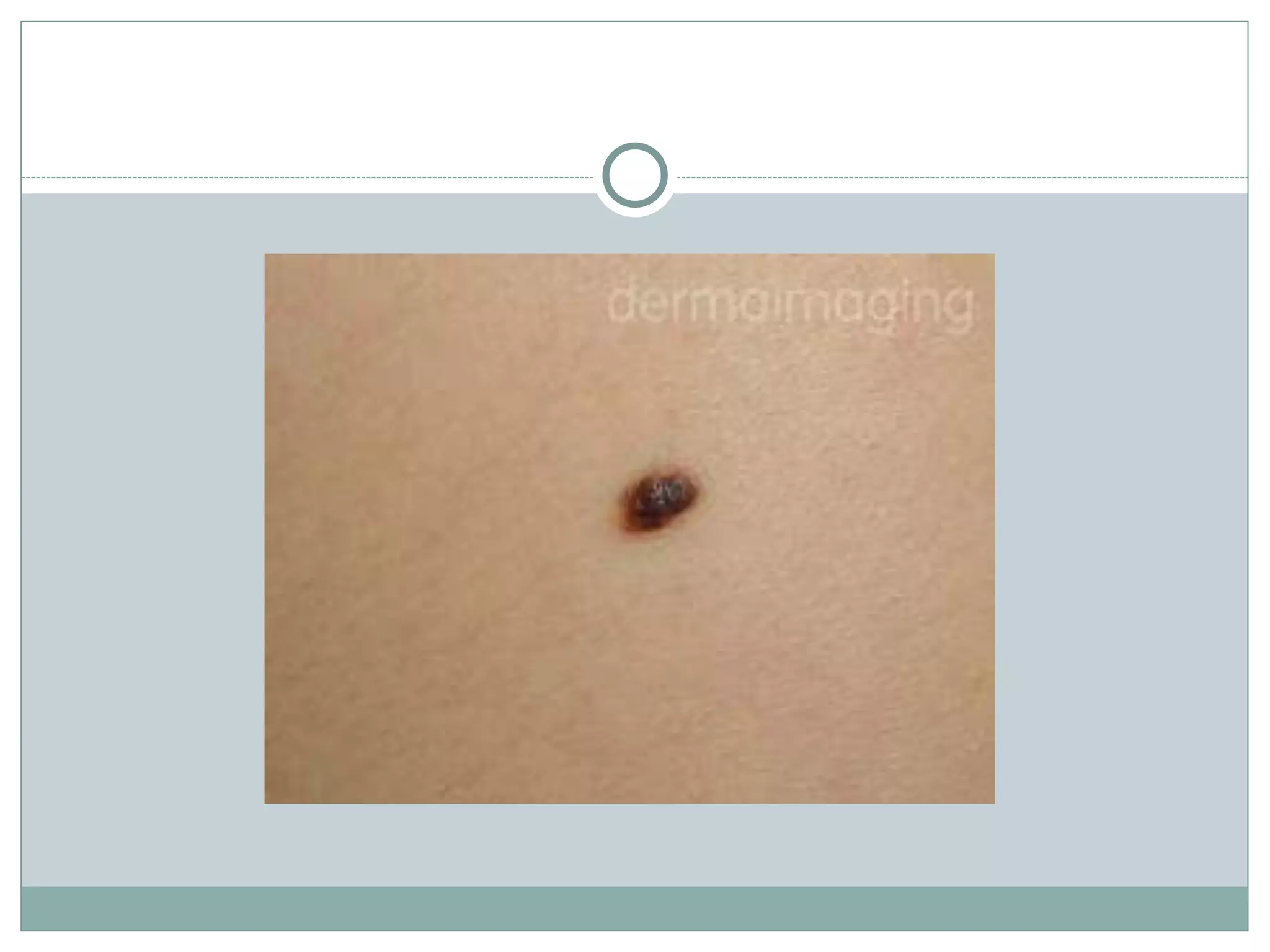 20181110 wound healing richard bodor_basics of wounds, lumps, bumps ...