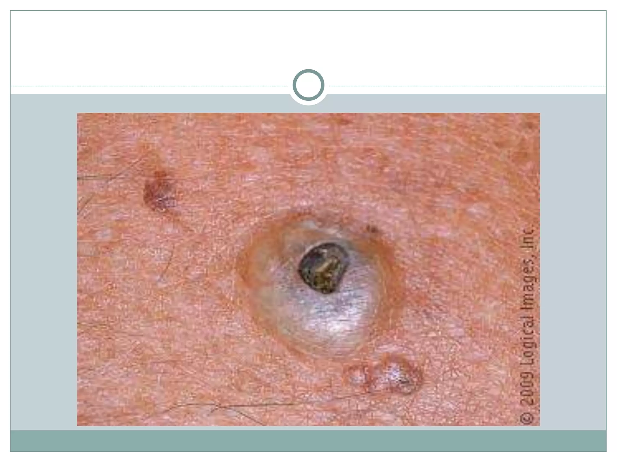 20181110 wound healing richard bodor_basics of wounds, lumps, bumps ...