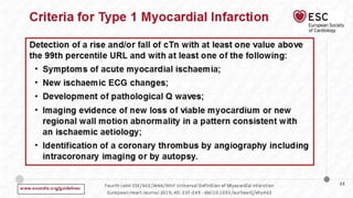2018 4th universal def of myocardial infarction slides | PPTX
