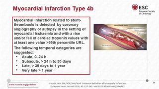 2018 4th universal def of myocardial infarction slides | PPTX