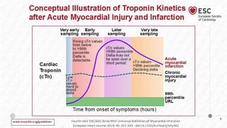 2018 4th universal def of myocardial infarction slides | PPTX