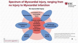 2018 4th universal def of myocardial infarction slides | PPTX