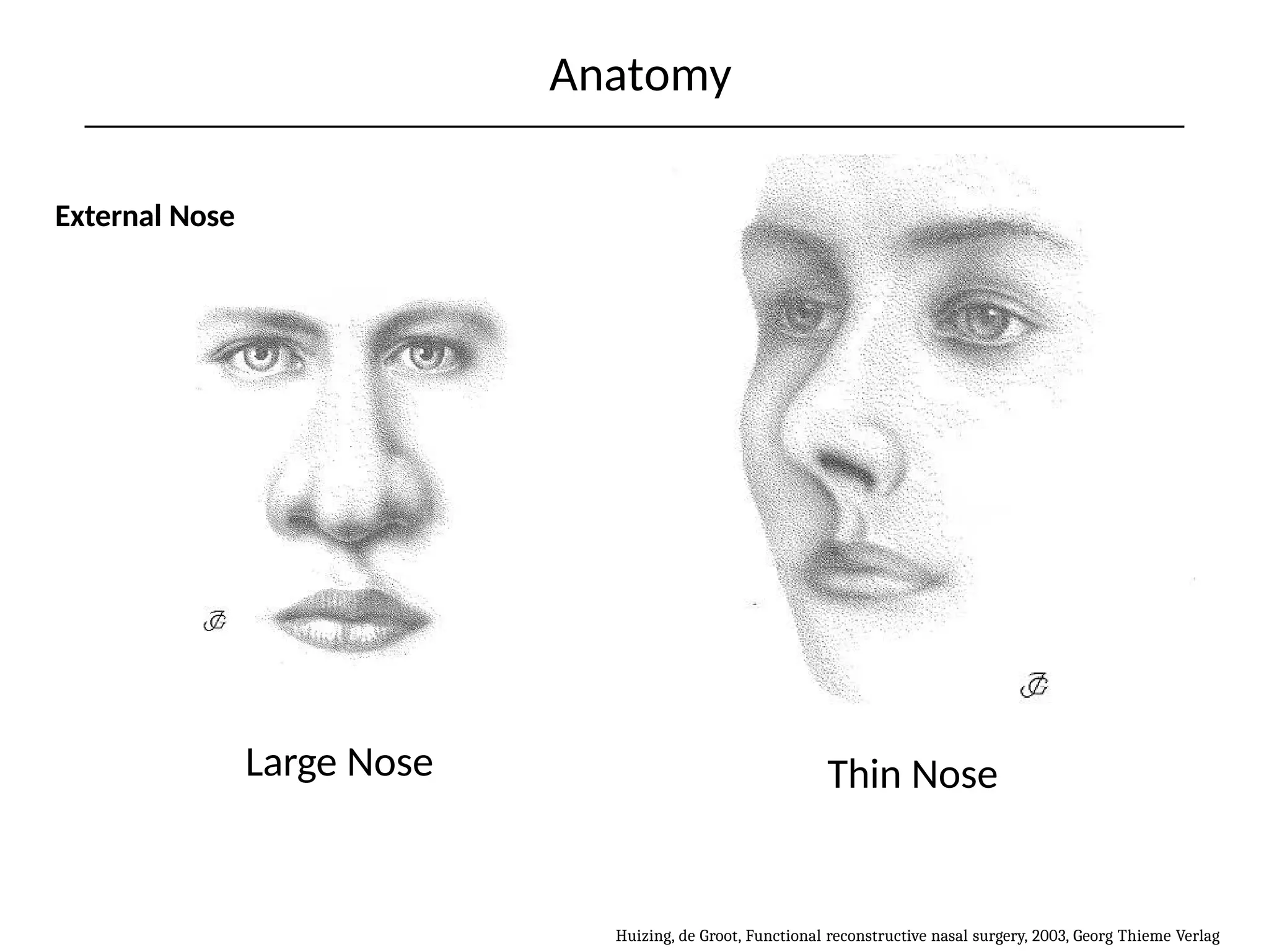2018_Anatomy___Physiology_Nose___Paranasal_Sinuses_-_Handout.pptx