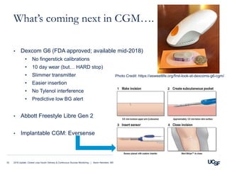 2018 Update in Diabetes Technology: Closed Loop, CGM, and More | PPTX