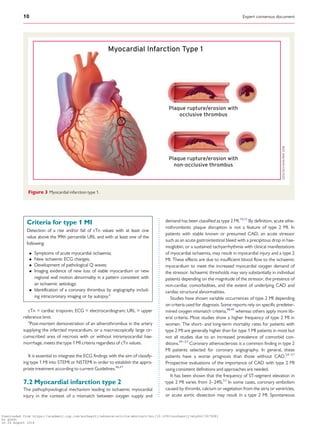 2018 fourth universal definition of myocardial infarction | PDF