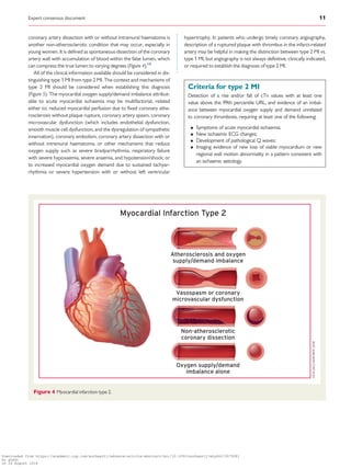 2018 fourth universal definition of myocardial infarction | PDF