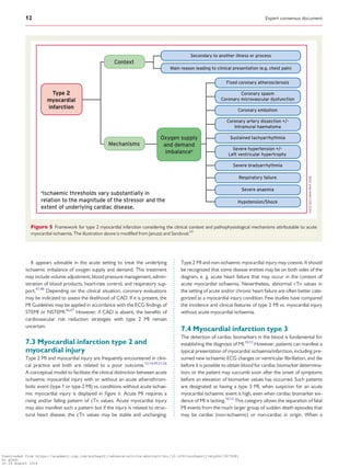 2018 fourth universal definition of myocardial infarction | PDF