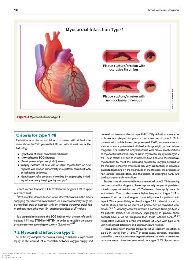 2018 fourth universal definition of myocardial infarction