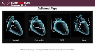 Crossing complex collaterals (Which wires? Microcath? | PPT