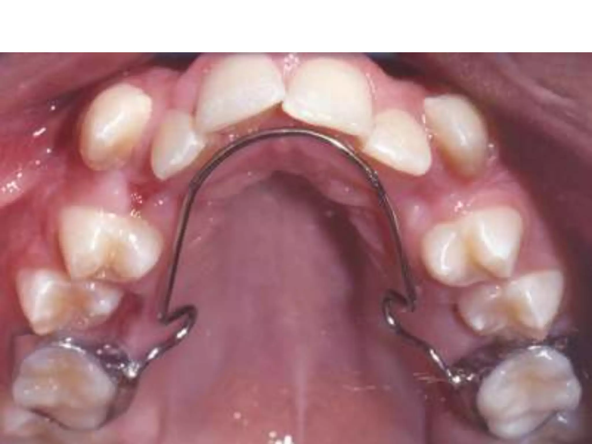 Final BDS Ortho Photo Slide Test (2018) | PPT