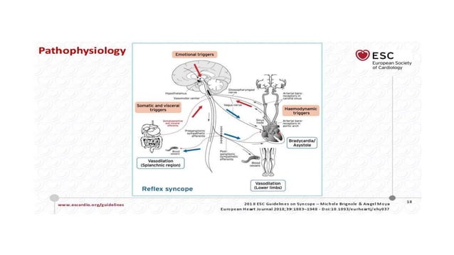 2018 Syncope Guidelines Official Slide-set for web.ppt