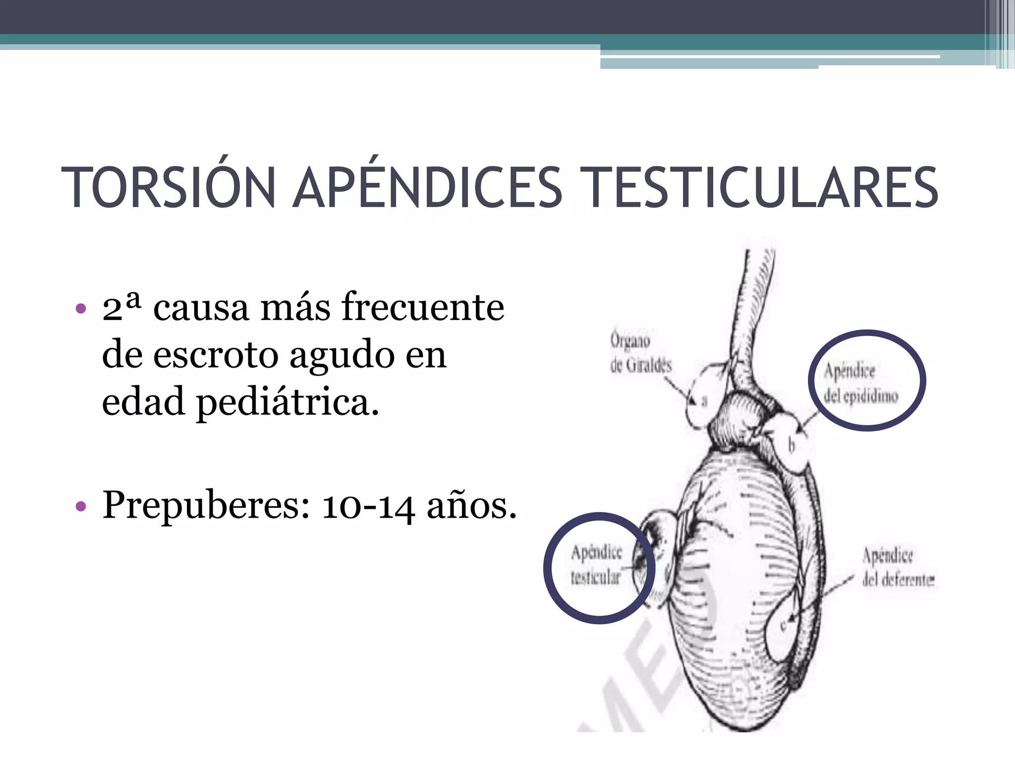 (2019 01-17) escroto agudo (ptt) | PPTX | Medical Health