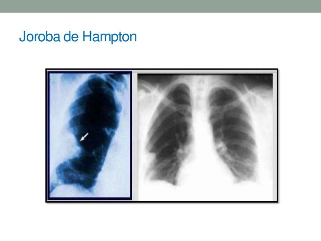 (2019 10-8) tep (ppt)