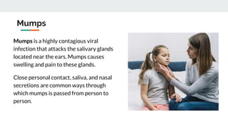 How Do Functional Medicine Doctors Approach Mumps? | PPT